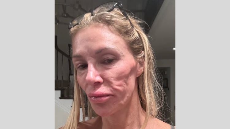 Real Housewives Star Reveals She has A Tumor In Her Face